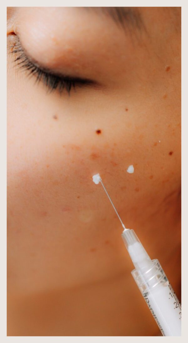 Radiesse - Curated Medical