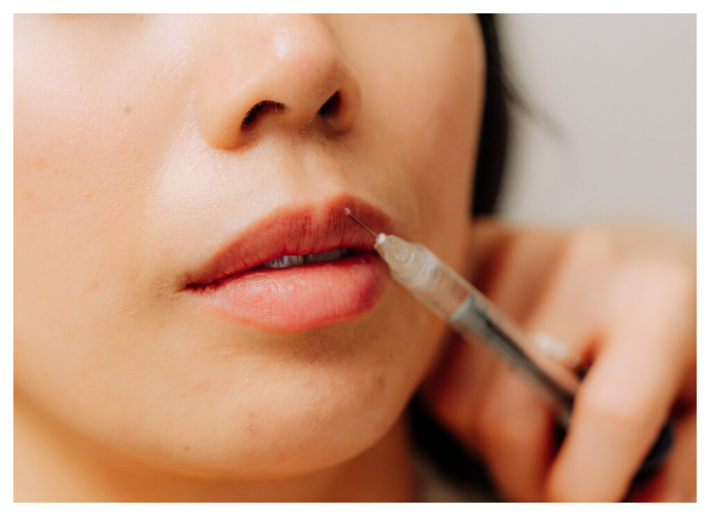 Restylane - Scottsdale, AZ - Curated Medical